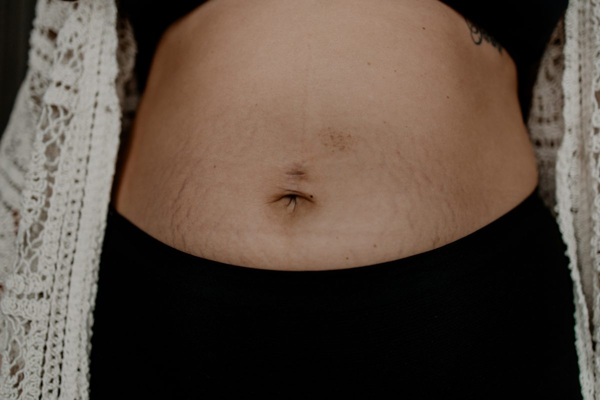 Placenta capsuleren – hype of helende kracht? - Dalalou Natuurlijk